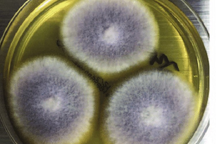 Hongo Fusarium Solani: ¿Qué es y cómo afecta a las personas? - Séptima ...